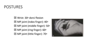 Hand dressings | PPTX