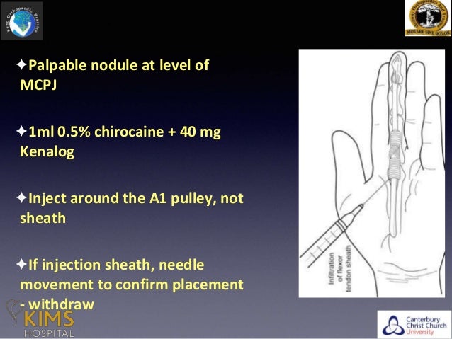 Kapandji Test A Score For Thumb And Hand Dexterity