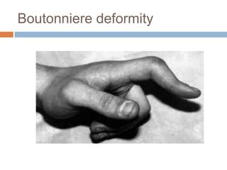 Examination of Hand | PPTX