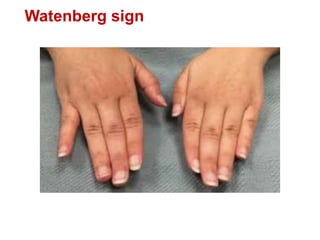 Examination of Hand | PPTX