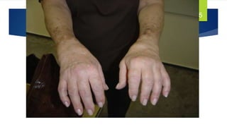hand examination.pptx