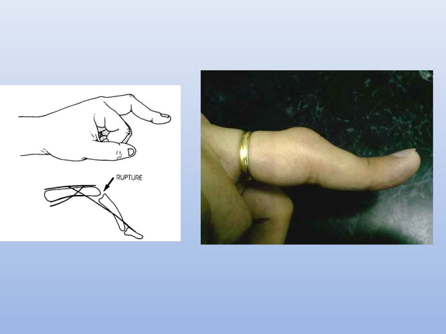 Hand examination | PPT | Death, Injury, or Military Conflict ...