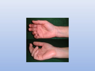 Hand examination | PPT