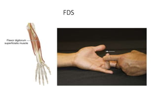 Hand examination.pptx