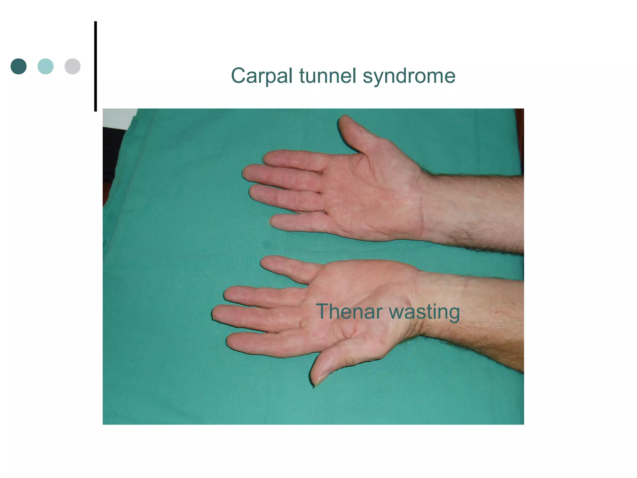 Hand examination in primary care | PPT