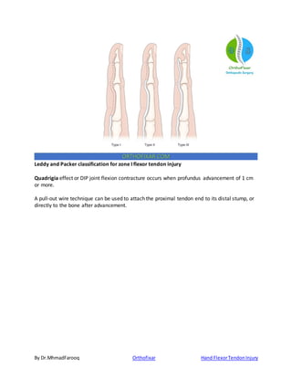 Hand Flexor tendon injury.pdf | Death, Injury, or Military Conflict ...
