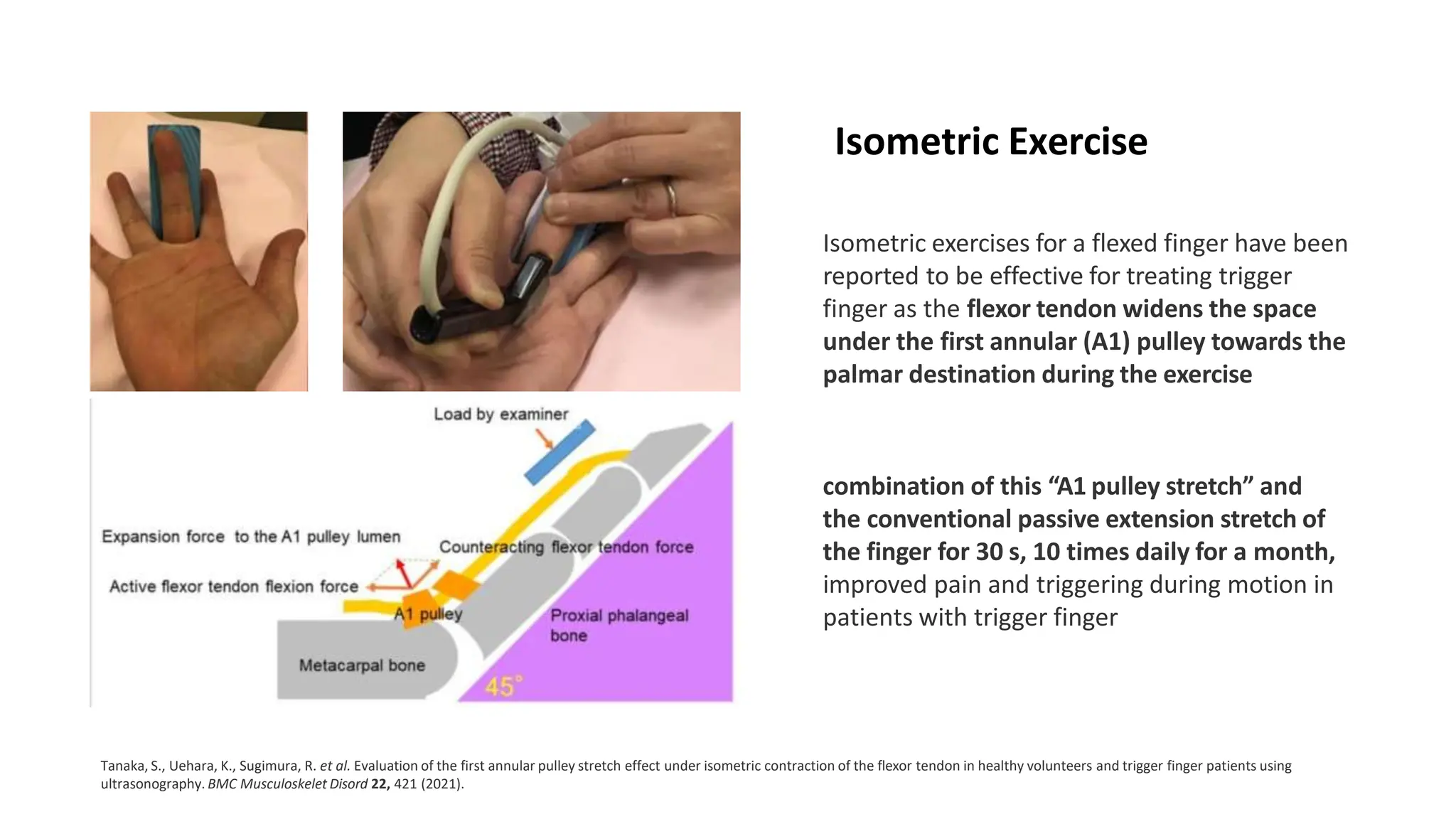 Trigger Finger presentation handfor.pptx
