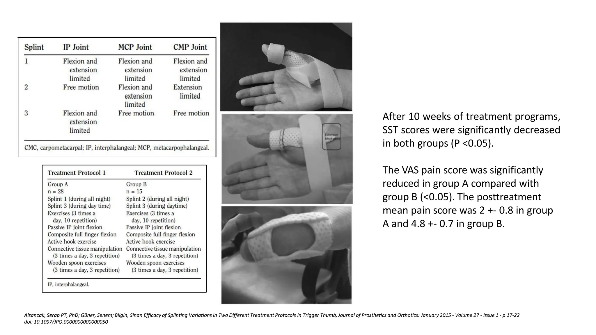 Trigger Finger presentation handfor.pptx