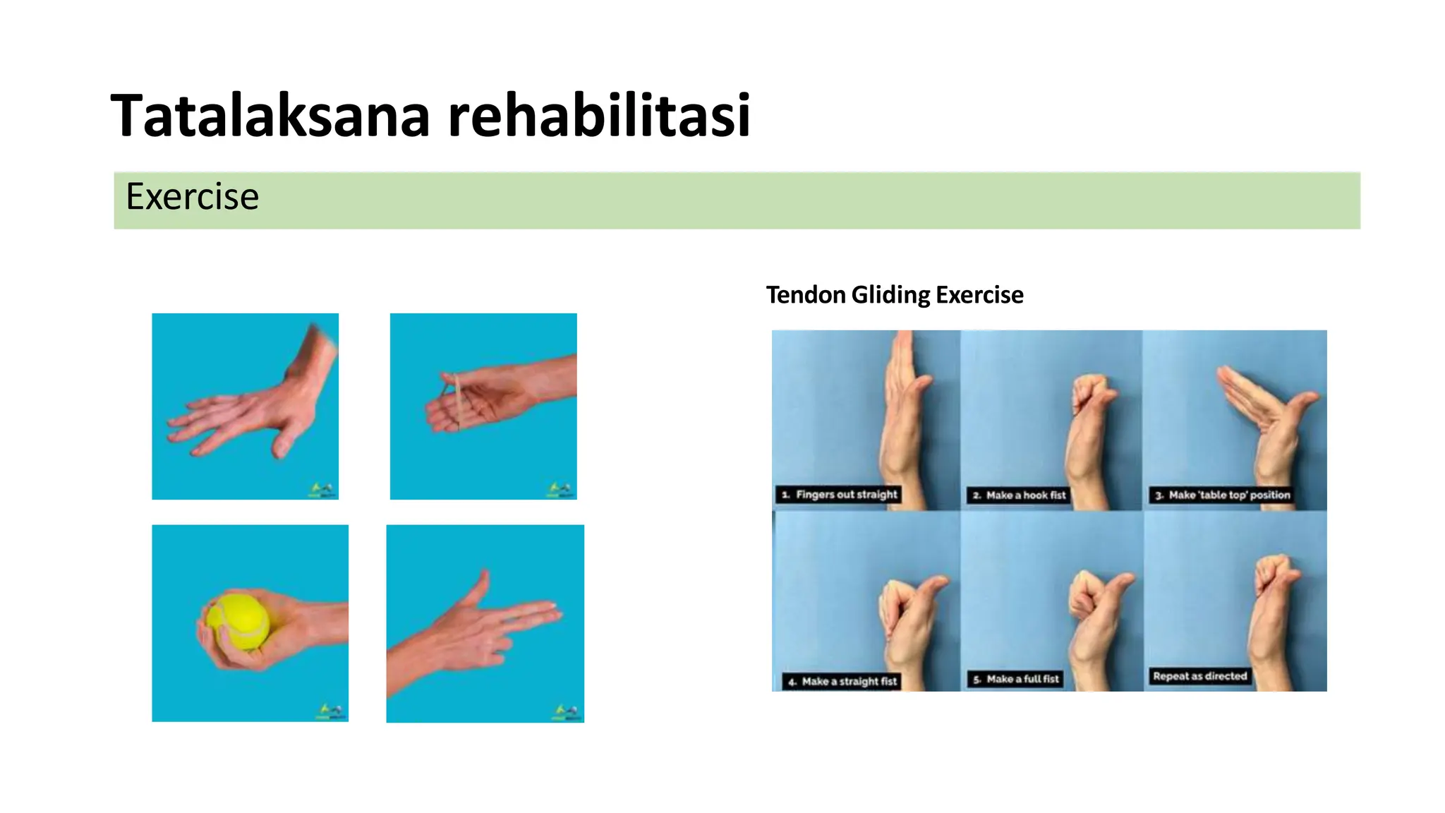 Trigger Finger presentation handfor.pptx