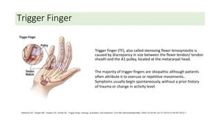 Trigger Finger presentation handfor.pptx