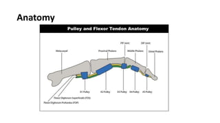 Trigger Finger presentation handfor.pptx