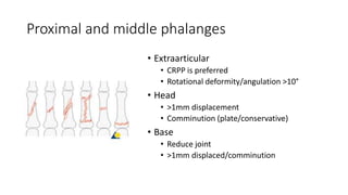 Hand fractures | PPTX