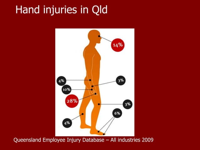 Hand hazard controls | PPT