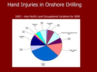 Hand hazard controls | PPTX
