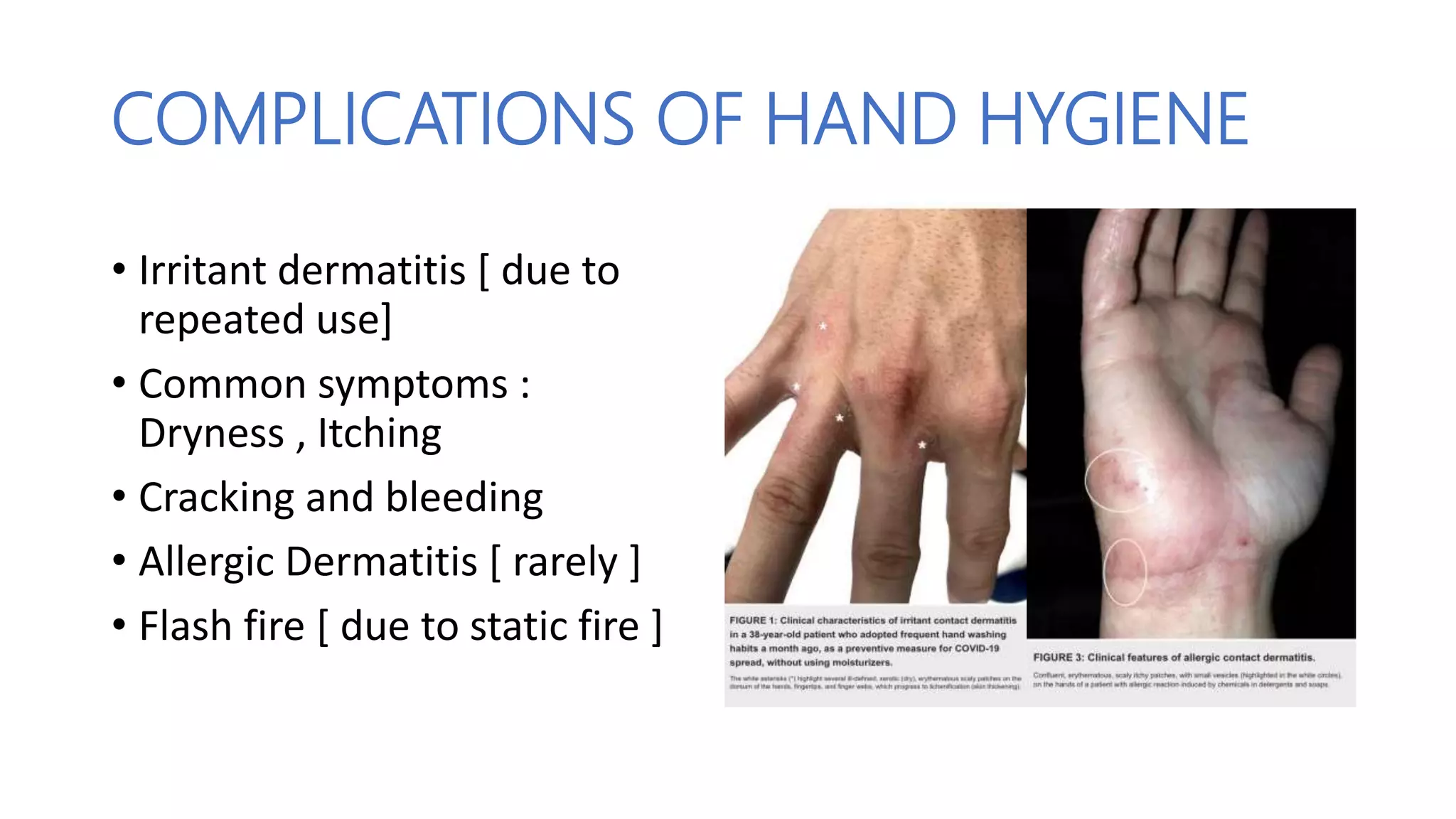Hand hygiene | PPTX
