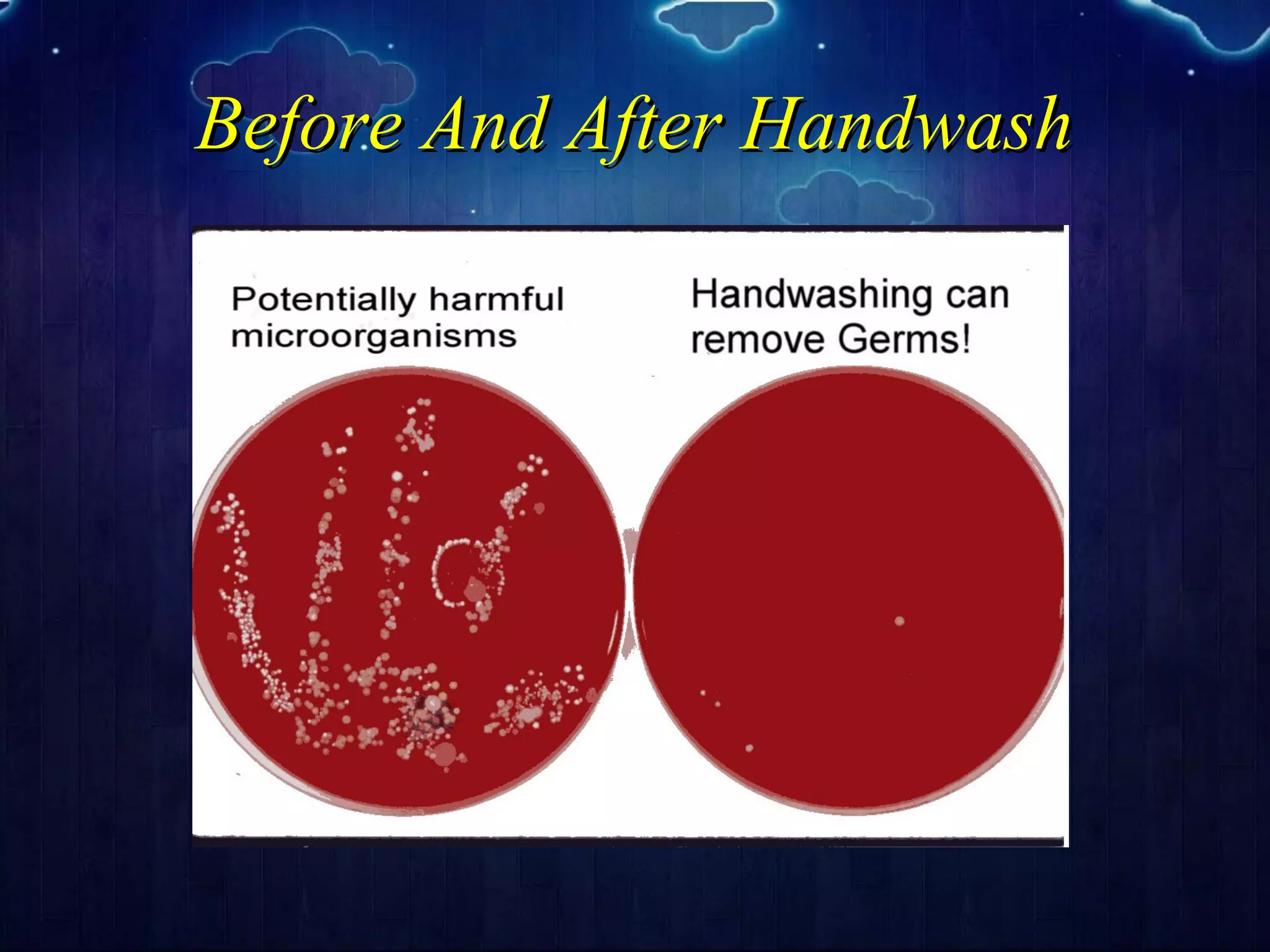 Hand hygiene nurses | PPT