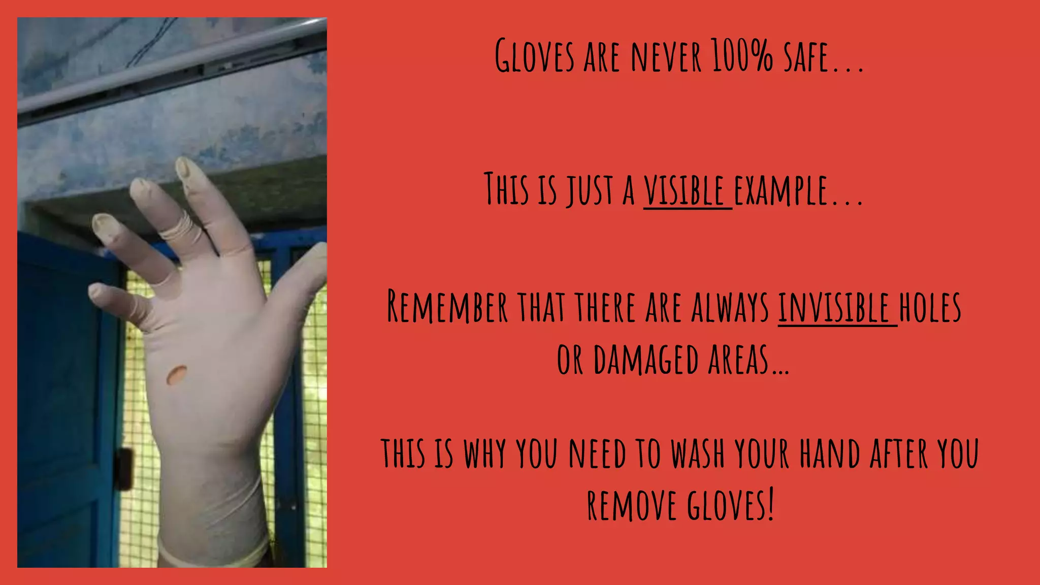 Hand hygiene and gloves use at gmlf hospital, chilakalapalli, india | PPTX