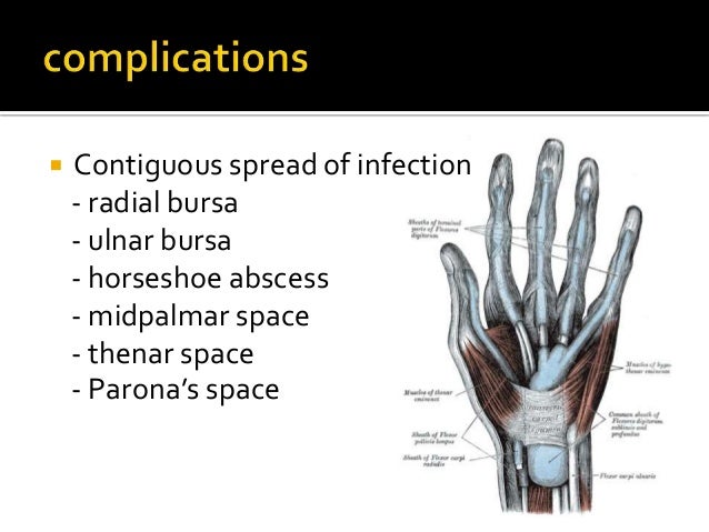 Horseshoe Abscess Hand Infections Of The Hand And Wrist: Anatomical