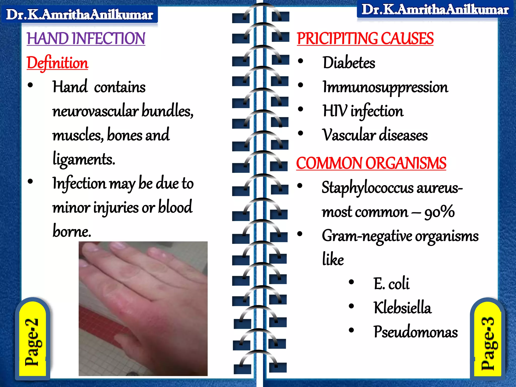 Hand infection | PPT