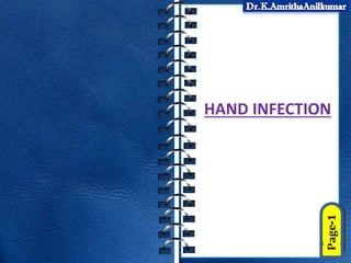 Hand infection | PPT