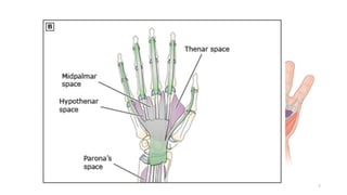 hand infectionby drbedrumohanmedgsr.pptx
