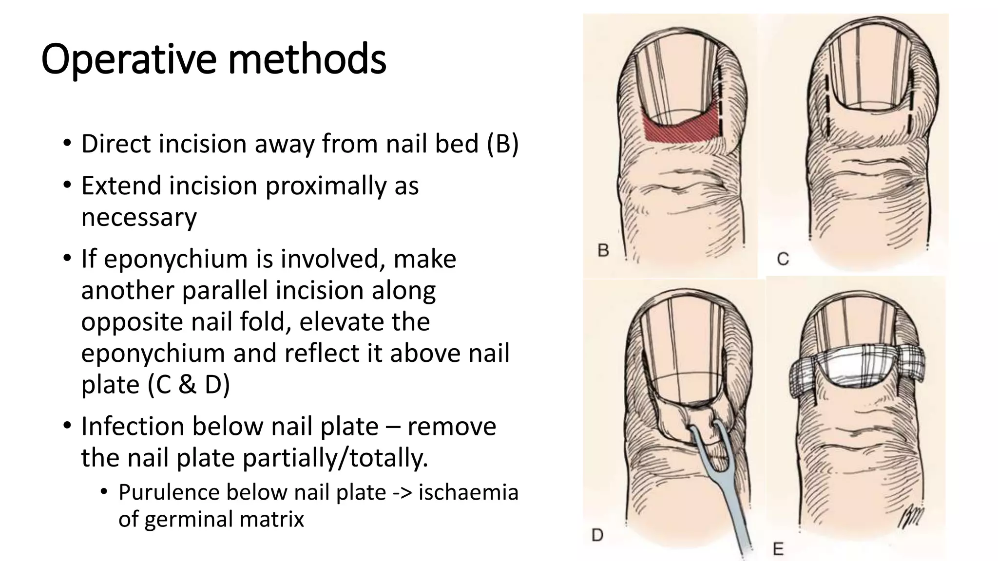 Hand Infection .pptx