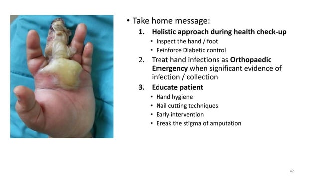 Hand Infection .pptx | Nail Care | Beauty