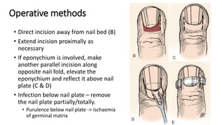Hand Infection .pptx | Nail Care | Beauty