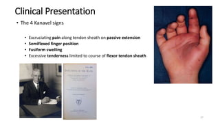 Hand Infection .pptx