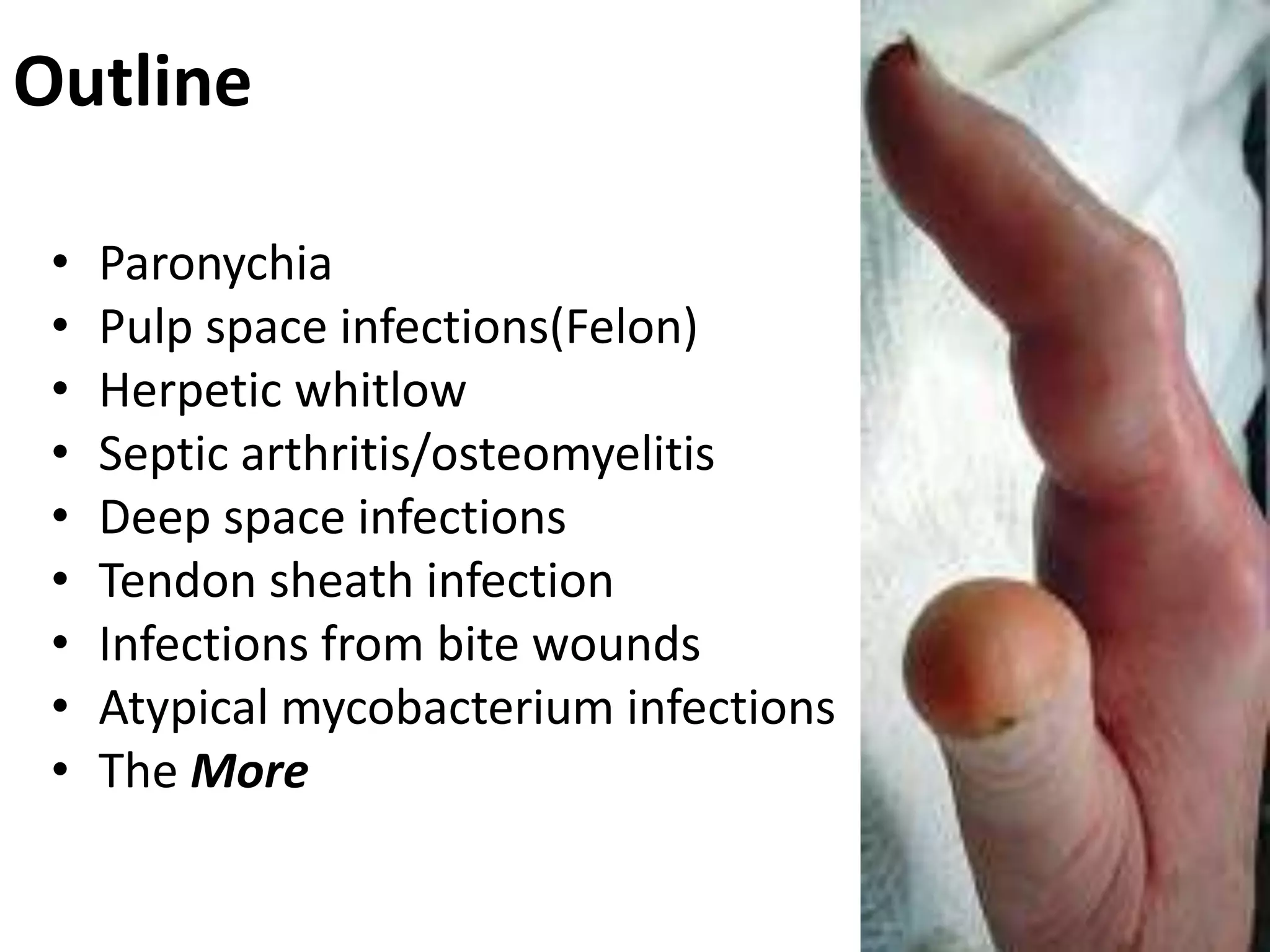 Hand infection & more | PPTX