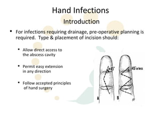 Hand infections | PPT