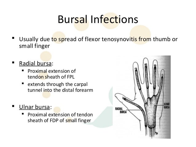 Hand infections