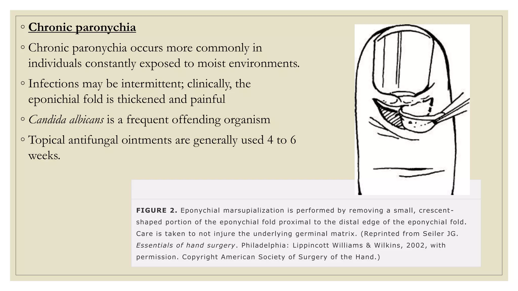 Hand infections | PPTX