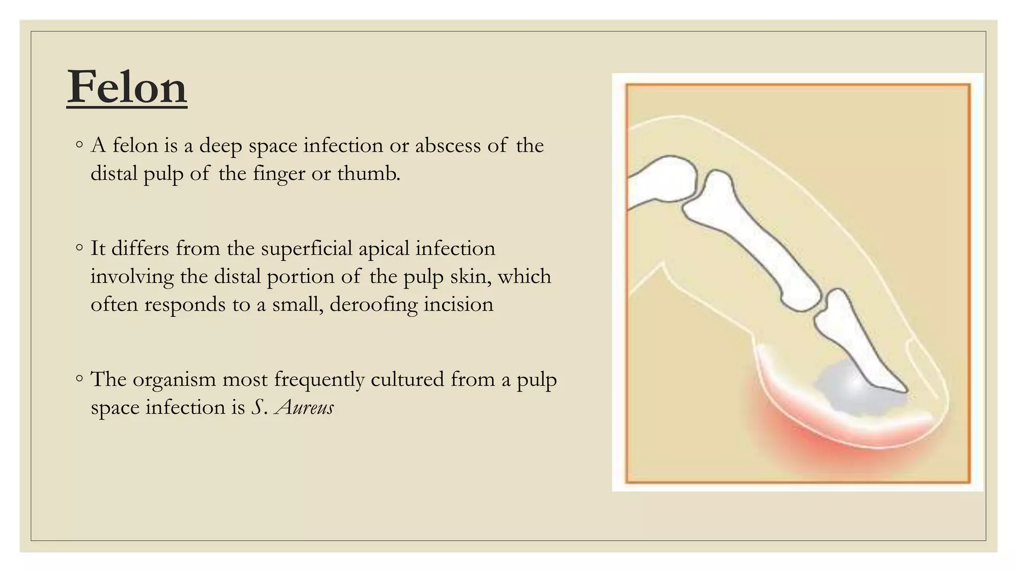 Hand infections | PPTX