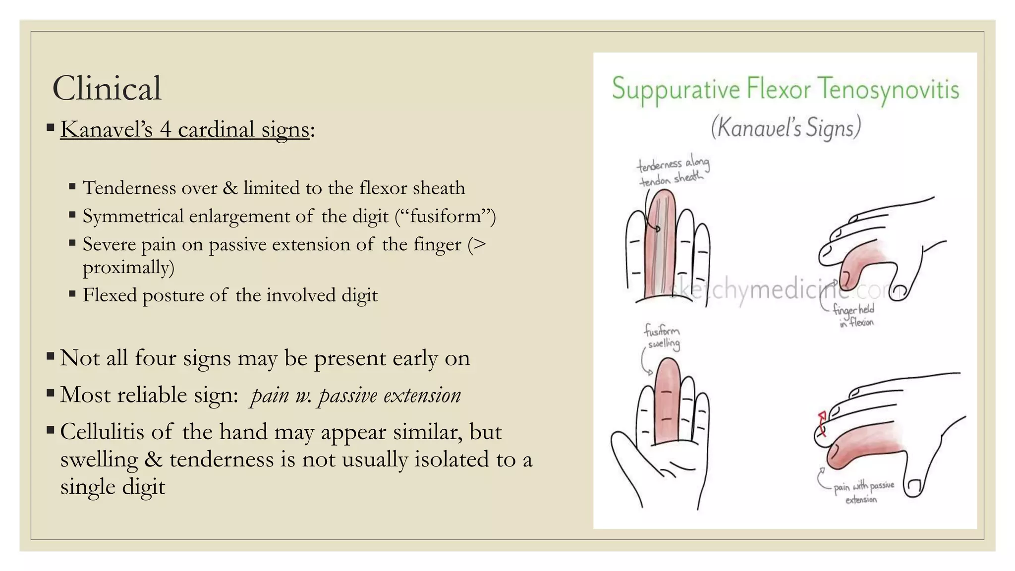 Hand infections | PPTX