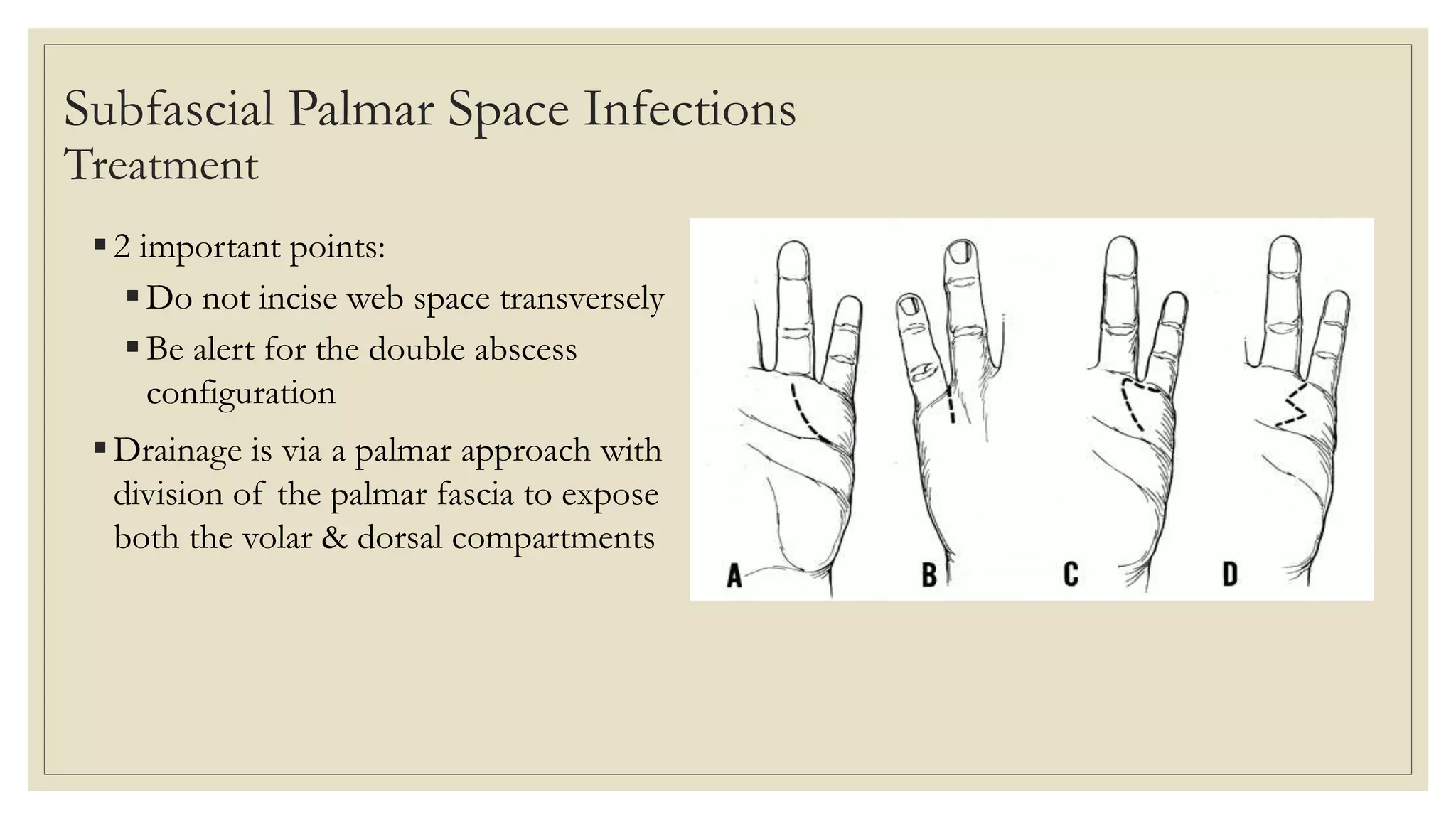 Hand infections | PPTX