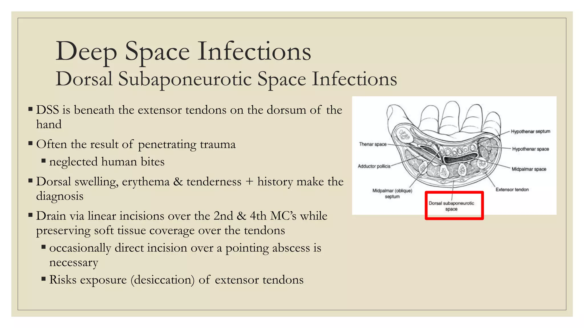 Hand infections | PPTX