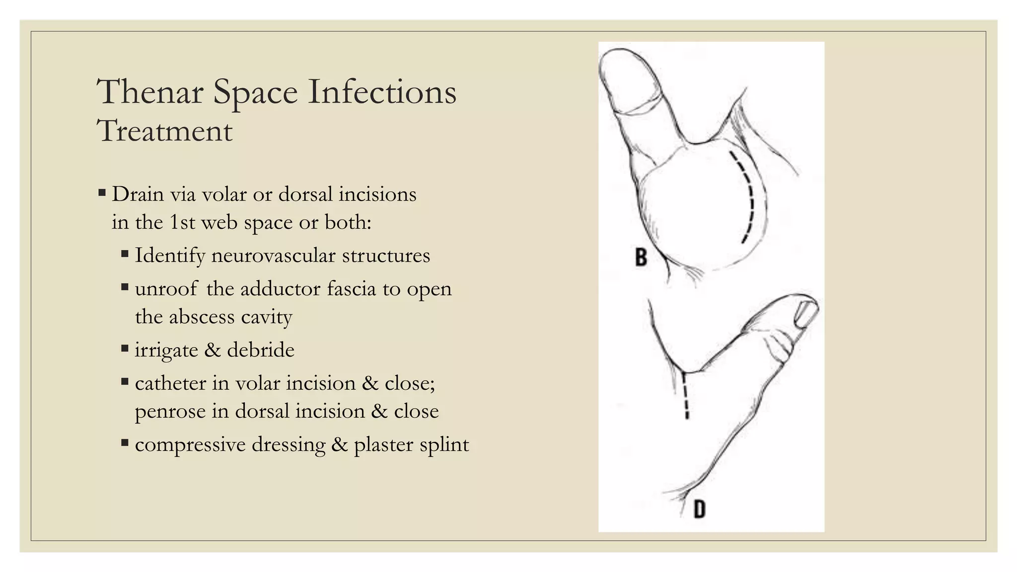 Hand infections | PPTX