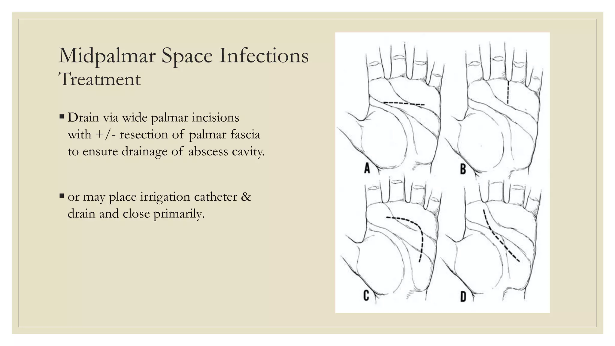 Hand infections | PPTX