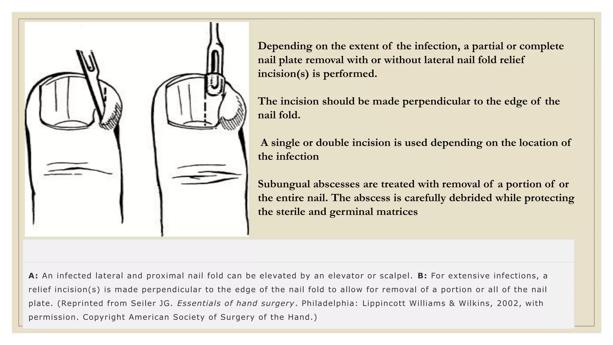 Hand infections | PPTX
