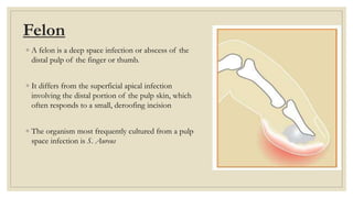 Hand infections | PPTX