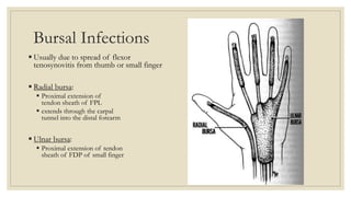 Hand infections | PPTX