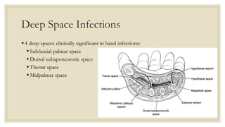 Hand infections | PPT