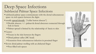 Deep Space Infections