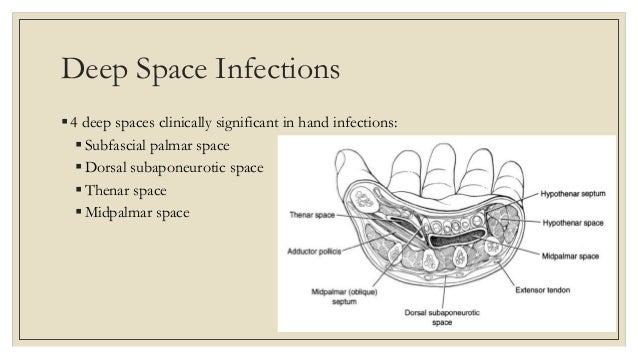 Hand infections