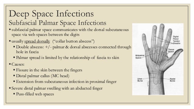 Hand infections