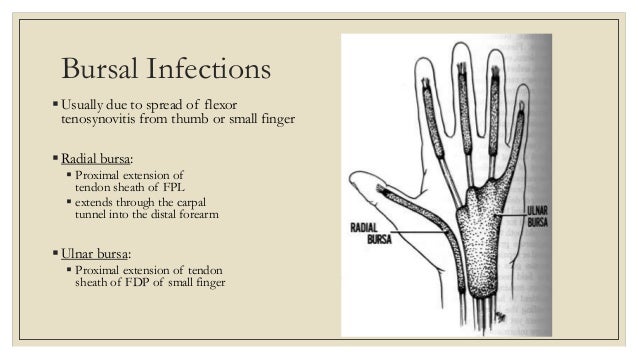 Hand infections