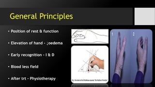 Hand & Foot infections | PPTX