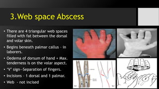 Hand & Foot infections | PPTX