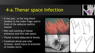 Hand & Foot infections | PPTX